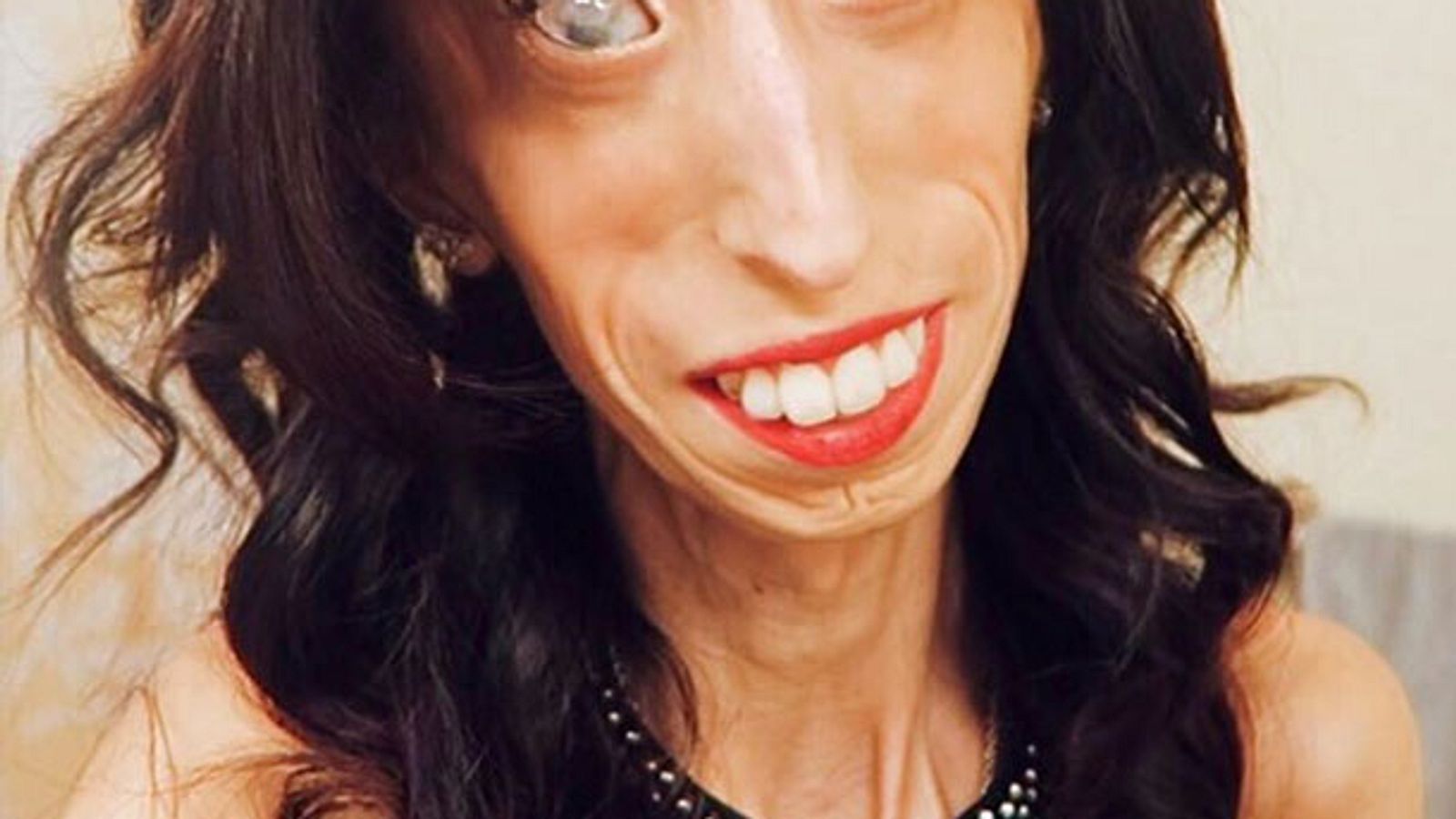 Lizzie Velasquez 11 Ans